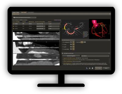Philips - CT Comprehensive Cardiac Analysis (CCA)