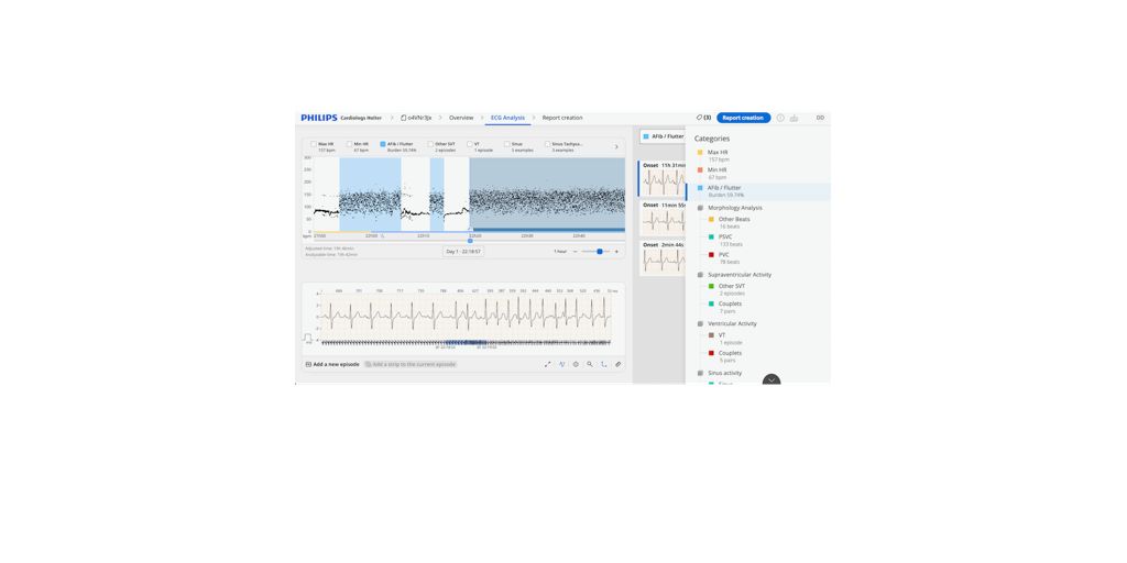 Cardiologs Holter - Philips