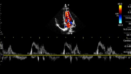 8 Best Portable Echo Ultrasound Machines for Cardiac Care