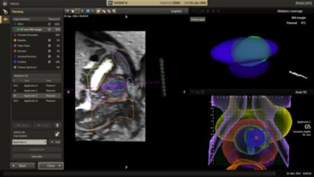 Philips - DynaCAD Urology HC784044