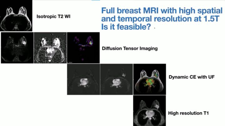 Best Practice Experience in Comprehensive Breast MRI with High Spatial ...