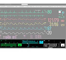Philips - Horizon Trends Trend measurement display