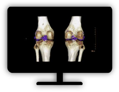 Philips - CT Dual Energy Viewer