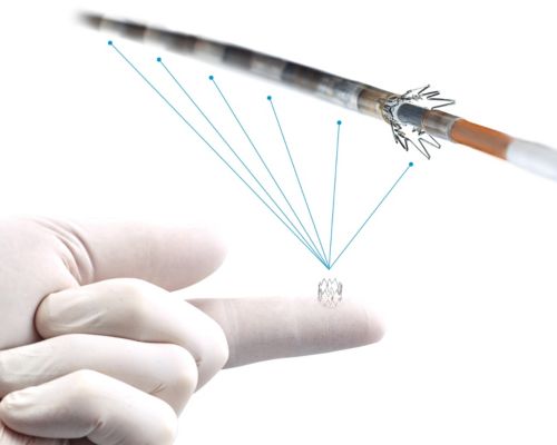 See clearly. Treat optimally. | Philips