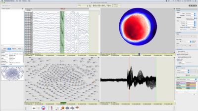 Net Station software | Philips