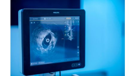 Philips - Duo Venous Stent System