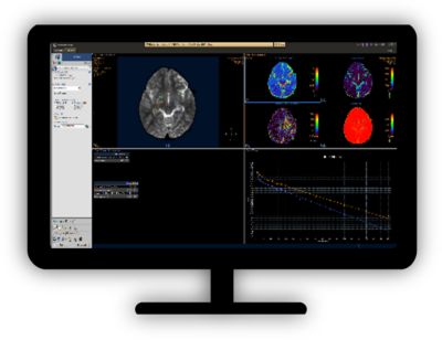 Philips - MR Advanced Diffusion Analysis