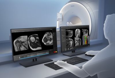 MR Smart Workflow - Philips