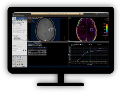 Philips - MR Permeability