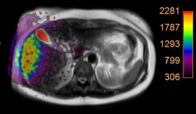 Philips - Multi Nuclei - Abdomen NMRF430C