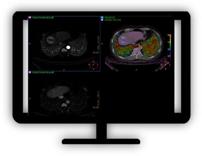 Philips - CT Multiphase Analysis