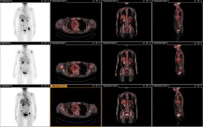 - Multi Modality Viewer - | Philips
