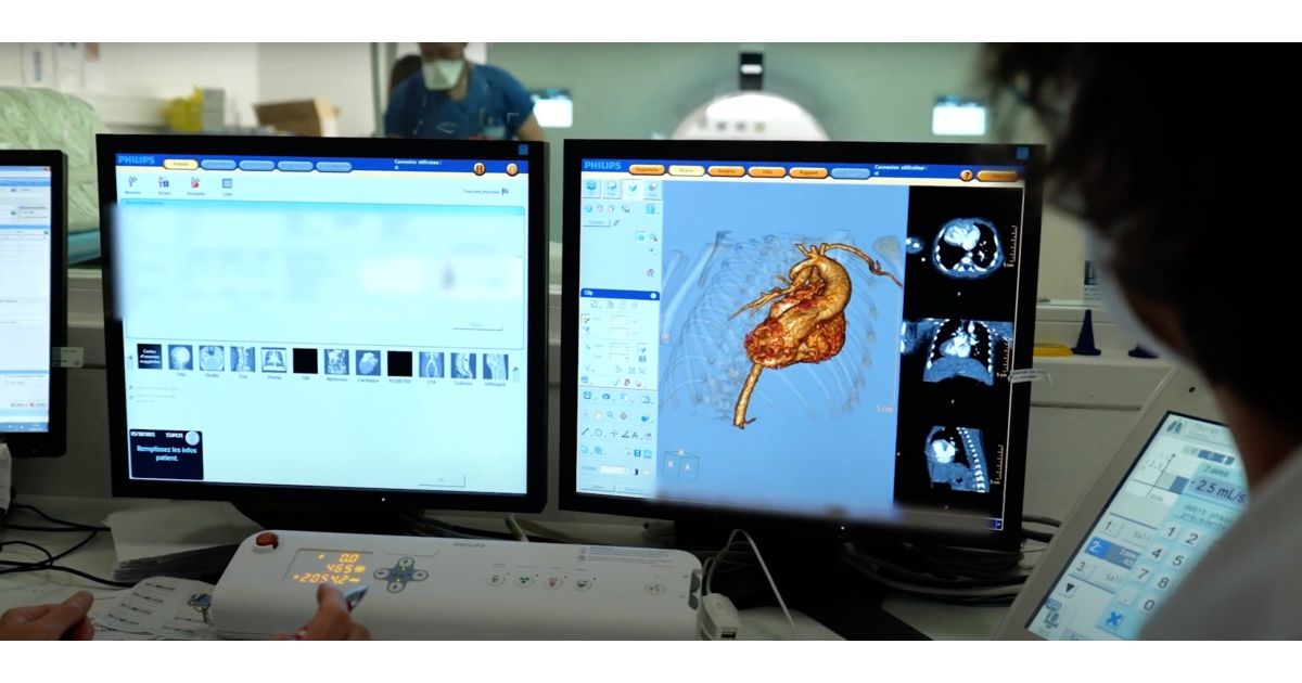 See the spectral-detector CT difference - Philips