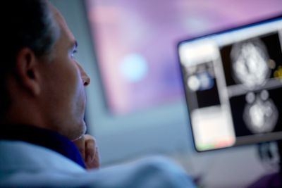 Compressed SENSE acceleration software - Philips