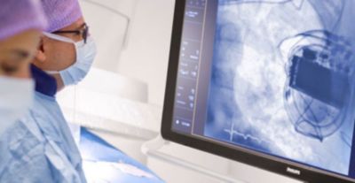 CIED Lead Extraction & Infection Treatment - Philips