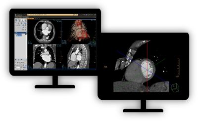 Philips - CT Cardiac Viewer Quick cardiac visualization