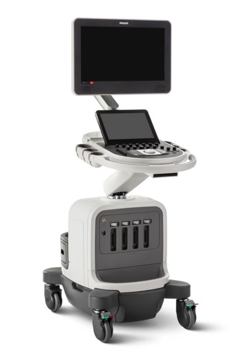 Affiniti CVx everyday ultrasound system