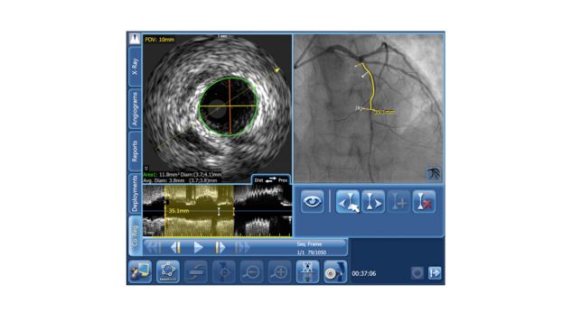 Philips Volcano - Eagle Eye Platinum Digital IVUS catheter