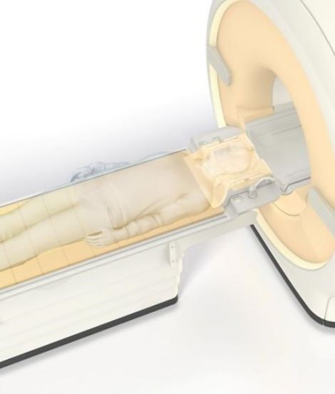 Ingenia dStream TotalSpine | Philips