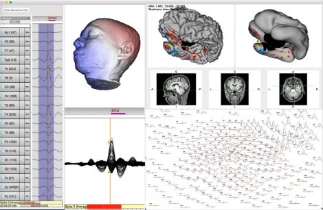 GeoSource 3 Research ESI software | Philips