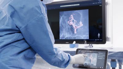 Philips - SmartCT Roadmap - Live 3D image guidance tool