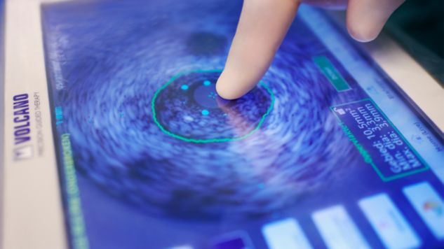 Philips Volcano - Core Mobile Precision guided therapy system