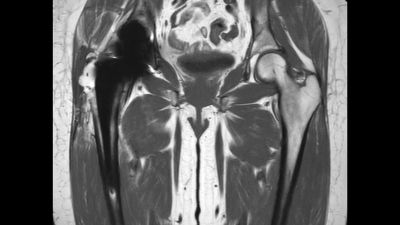 Philips - O-MAR - MSK MR Clinical application