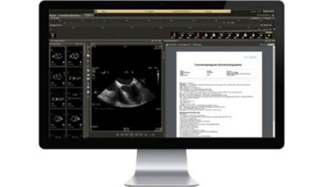 IntelliSpace Cardiovascular | Multi-modality cardiology image and ...