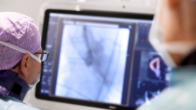 Philips - HeartNavigator - Philips