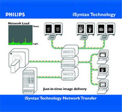IntelliSpace PACS iSyntax Technology | Philips