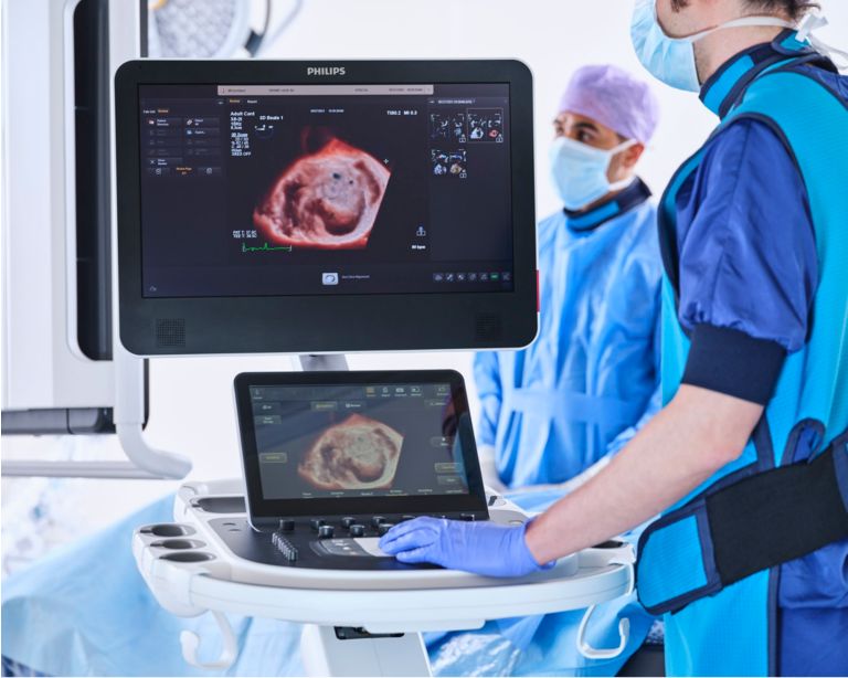 Ultrasound transducers - Philips