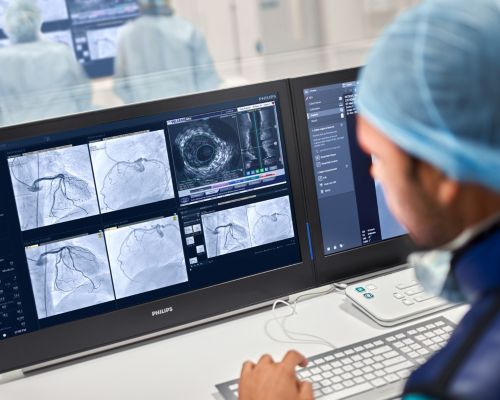 ClarityIQ Technology - Philips