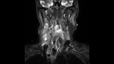 Philips - Compressed SENSE MR Clinical Applications