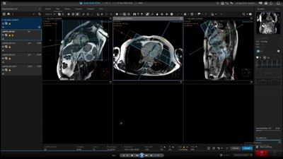 Philips - Easy Scan Plan - cardiac NMRF556C MR Clinical Applications