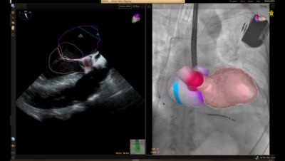 Philips - EchoNavigator