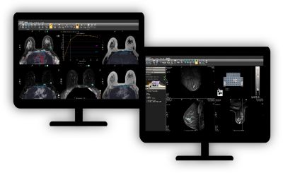 DynaCAD Breast | Philips