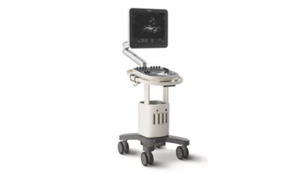 Philips - ClearVue 550 Ultrasound system