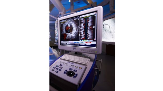 Philips Volcano - Core Mobile Precision guided therapy system