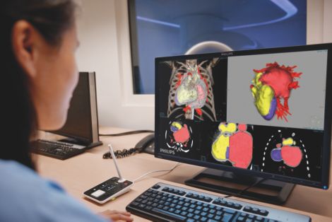 IntelliSpace Portal 10 | Philips