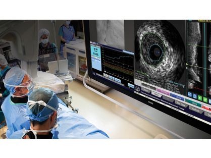 Philips Volcano - Core Sistema de terapia guiada de precisión