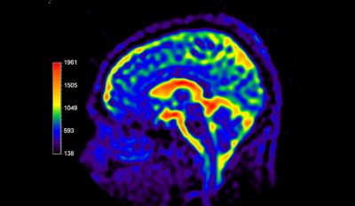 Philips - Multi Nuclei - Brain HCNMRF430A