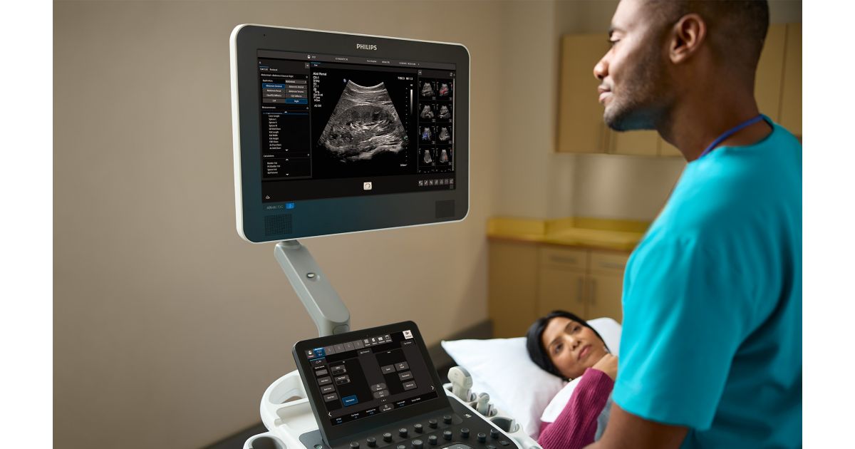 General imaging ultrasound - Philips