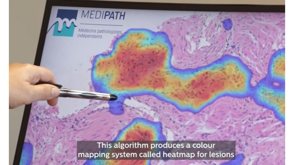 Digital pathology at Medipath | Healthcare | Philips