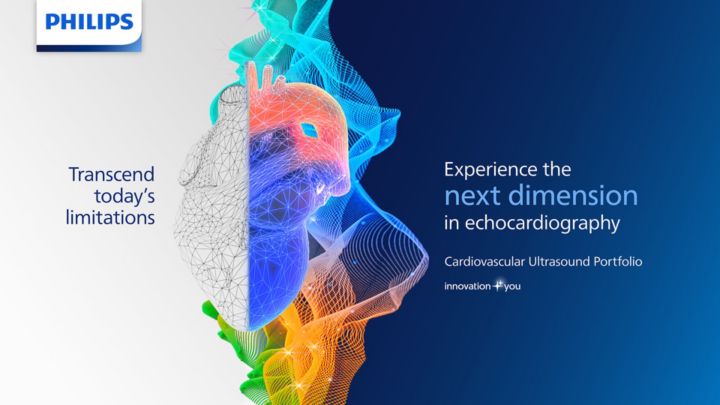 Platforma ultrasonograficzna CV firmy Philips — Philips Healthcare
