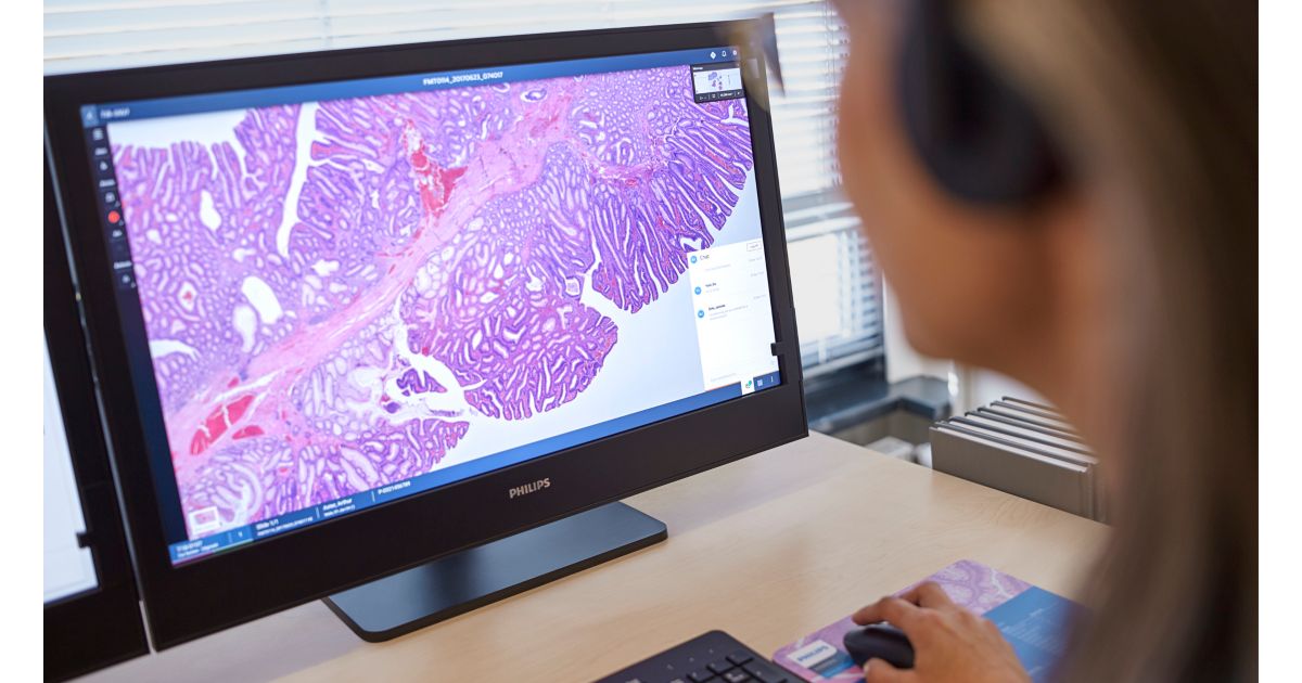 Large-scale digital pathology in Finland - Philips