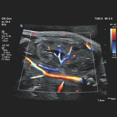 Flow Viewer – Products & Services - Philips