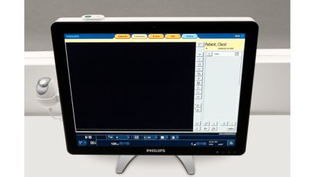 DigitalDiagnost Digital radiography solutions | Philips Healthcare