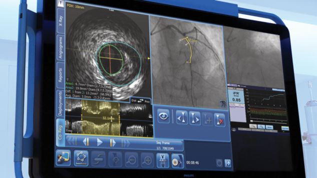 Philips Volcano - SyncVision Precision guidance system