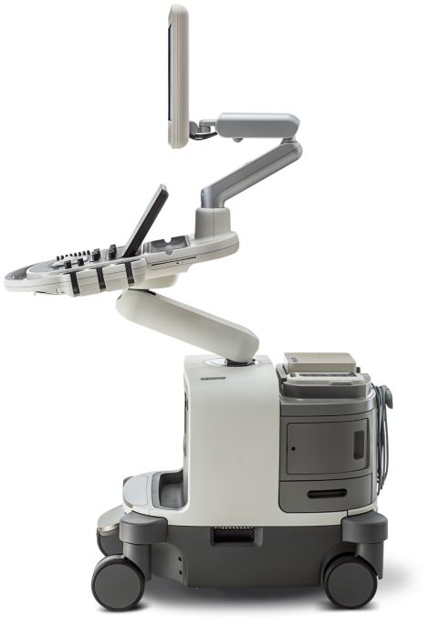 Ultrasound Image Fusion and Needle Navigation | Philips Ultrasound