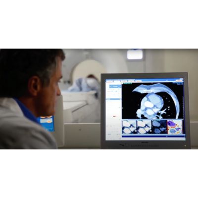 Cardiac imaging with spectral-detector CT - Philips